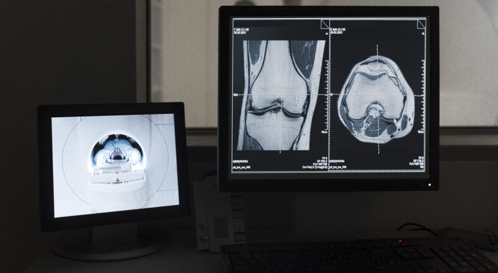 Xrays in Johannesburg Quick, Painless | Proscan Radiology